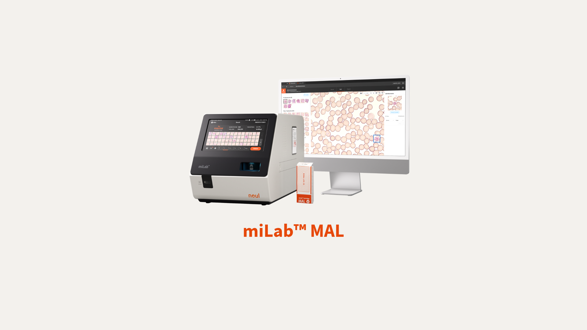 [ESCMID 2026] AI-Based Digital Microscopy for Malaria Diagnosis ...